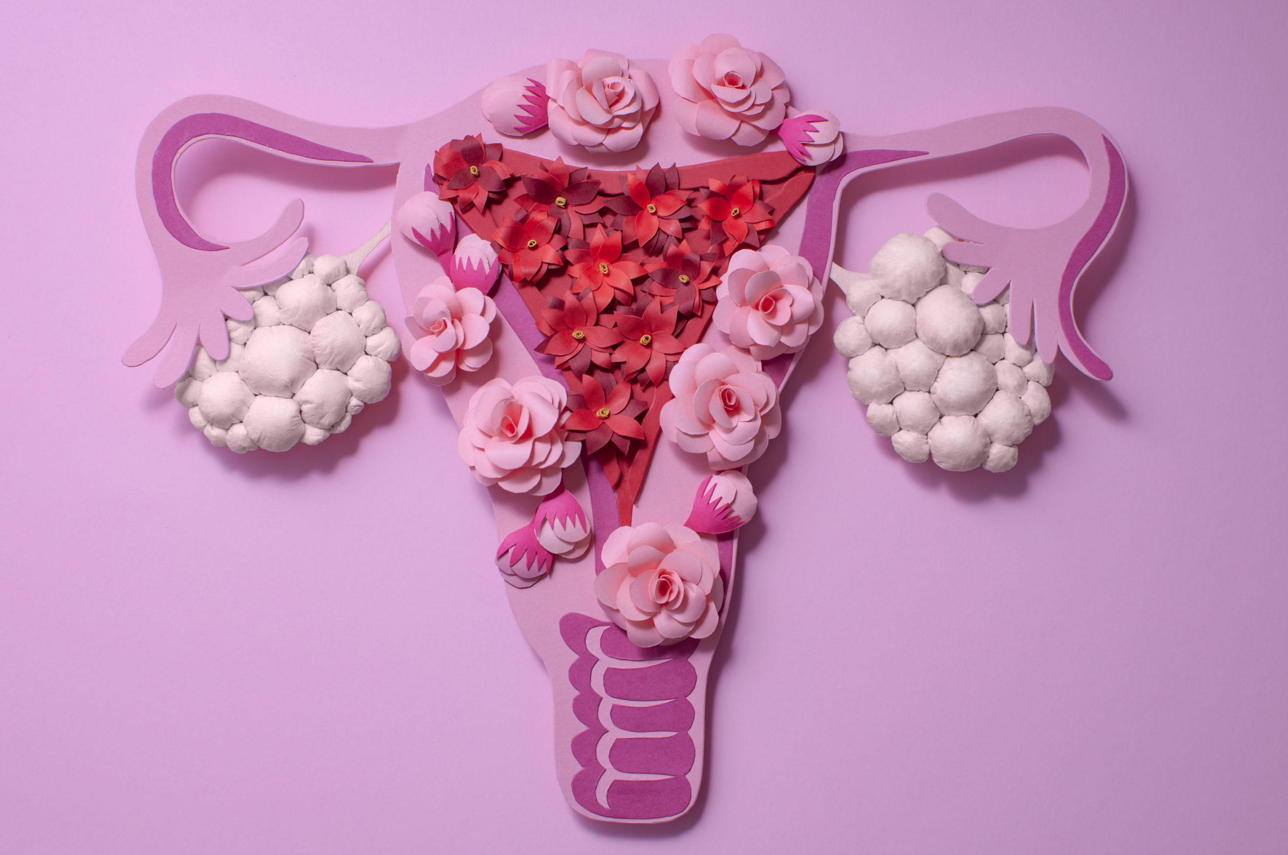 PCOS and Fertility - First Steps Fertility & Women's Health
